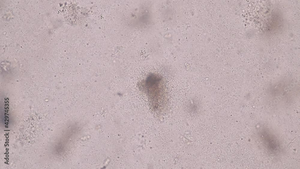 Bacteria,Protozoa and Green Algae in waste water under the microscope ...