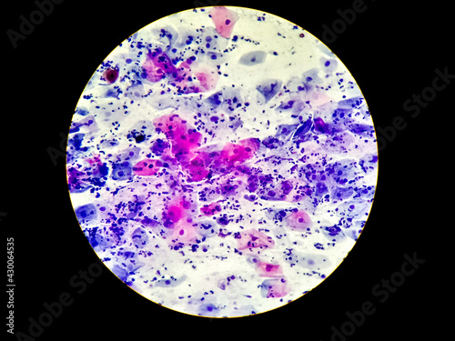 Conventional pap smear microscopic image of Endocervical cells and ...