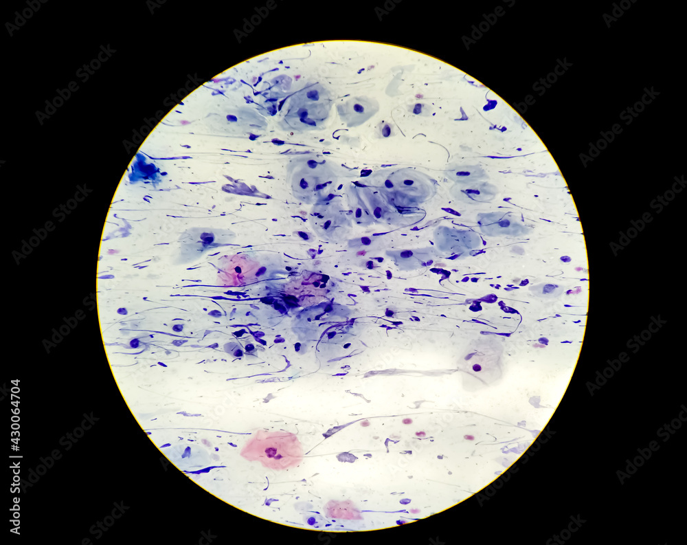 Conventional pap smear microscopic image of Endocervical cells and ...