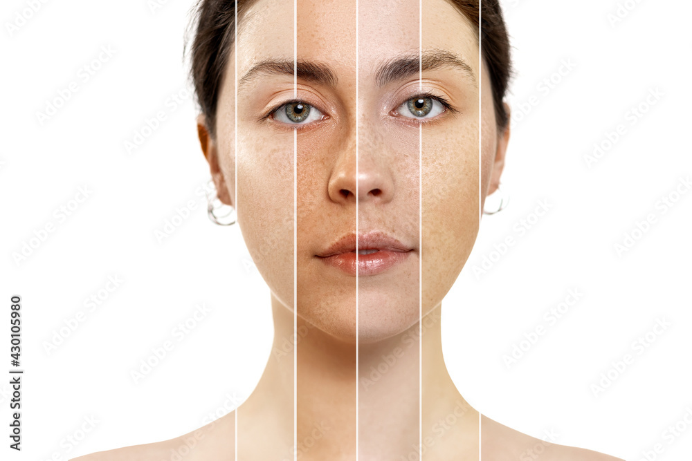 Portrait of a close-up of a brunette woman, with a face with a ...