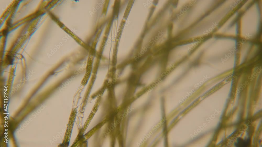 Chloroplast Under a Microscope Dead Plant. Cell Division. Dead Plant ...