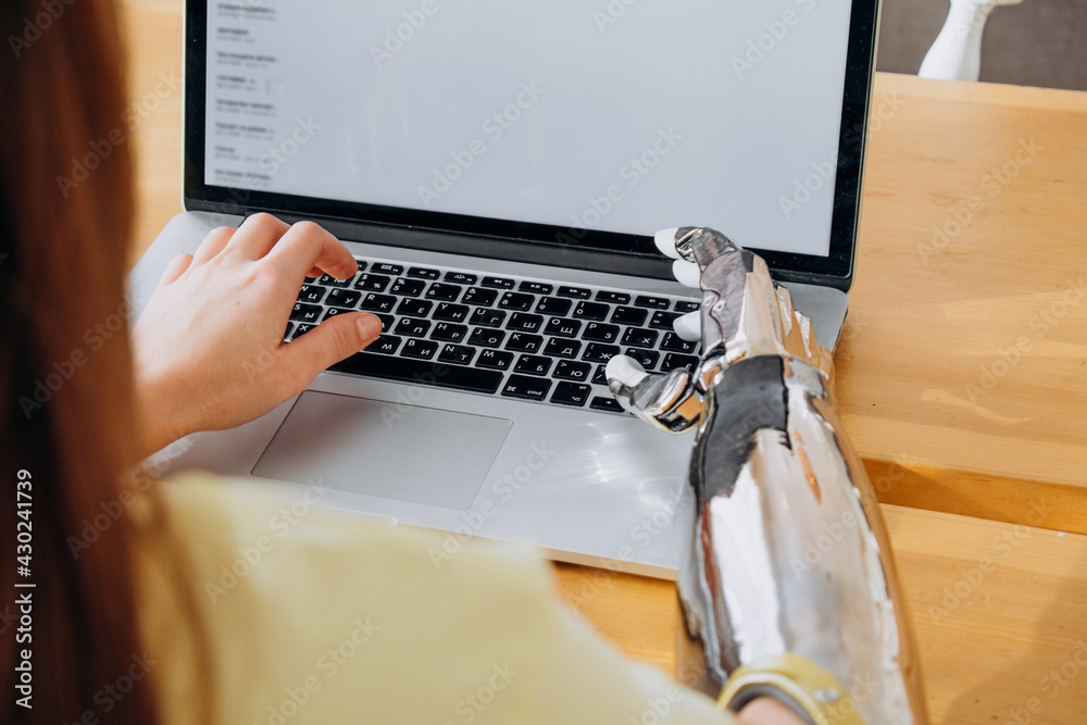 Young woman uses modern metal bionic arm to type on laptop keyboard ...