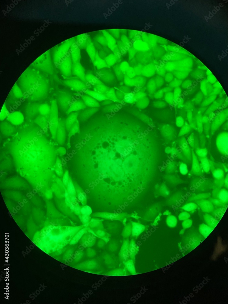 Polyploid human cell and expression of plasmid DNA encoding green ...