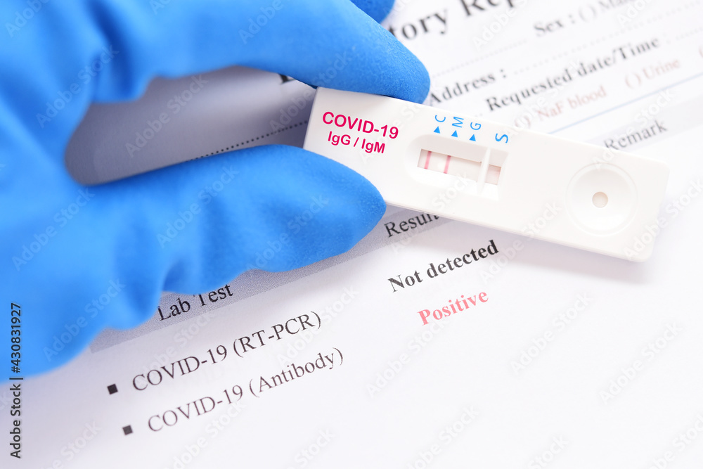 COVID-19 negative result by RT-PCR method but positive result by rapid ...
