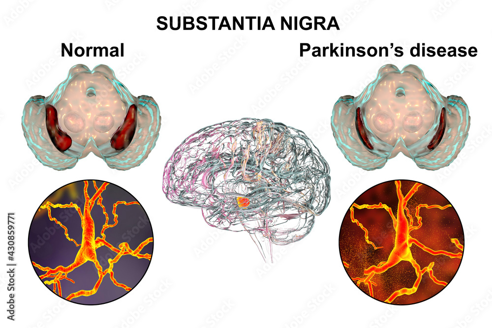 substantia-nigra-dopamine