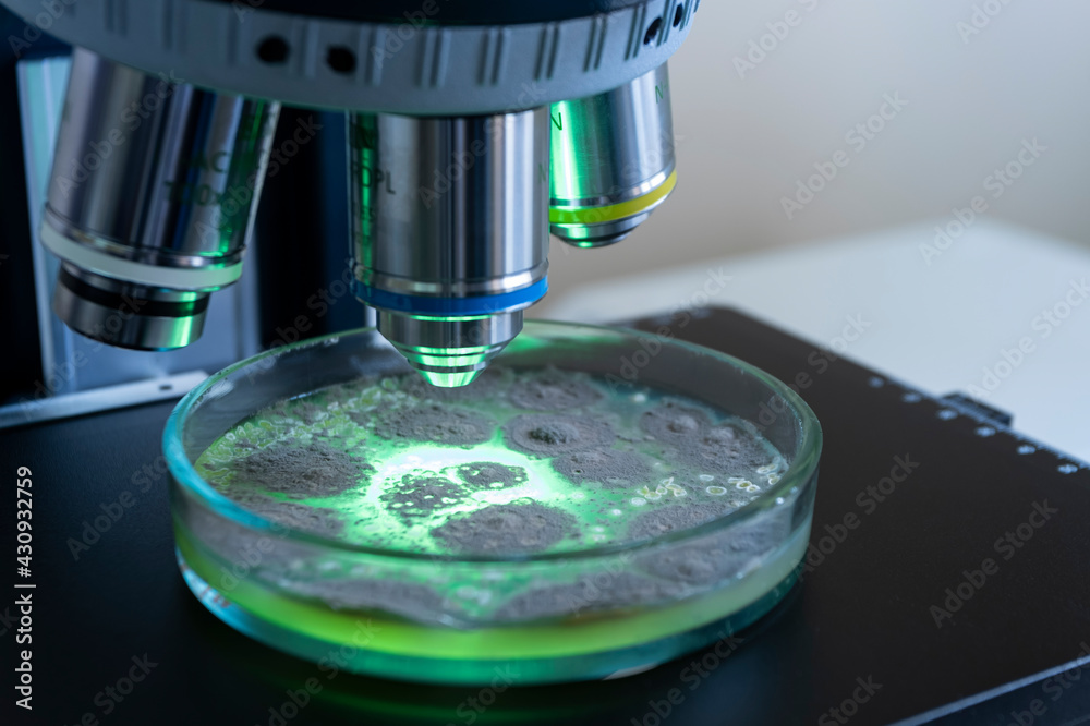 A petri dish with bacteria under a microscope, highlighted in green ...