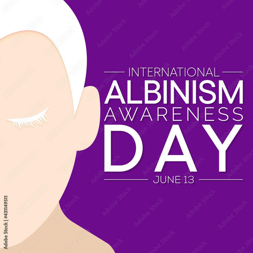 Vetor do Stock: International Albinism awareness day is observed every ...