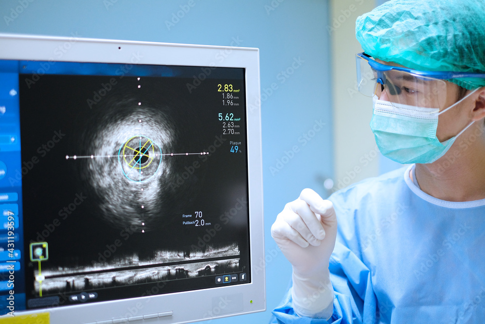 doctor used Intravascular ultrasound imaging (IVUS) machine at cardiac ...