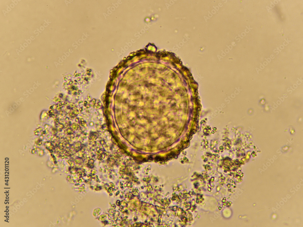 Egg of Ascaris lumbricoides (roundworm) in human stool, analyze by ...