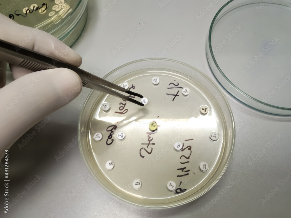 Scientist or microbiologist place antibiotic disk, diagnosis for ...