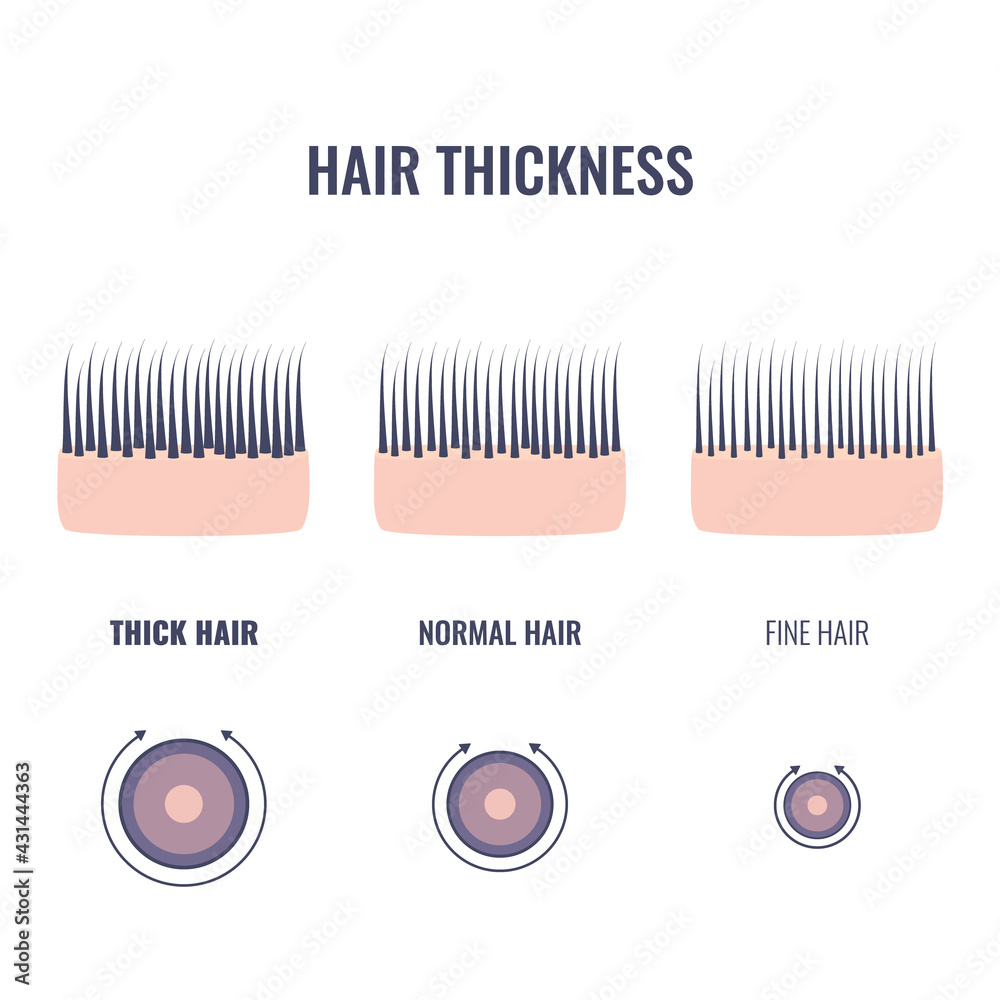 Hair thickness types classification set. Skin cross-section with fine ...