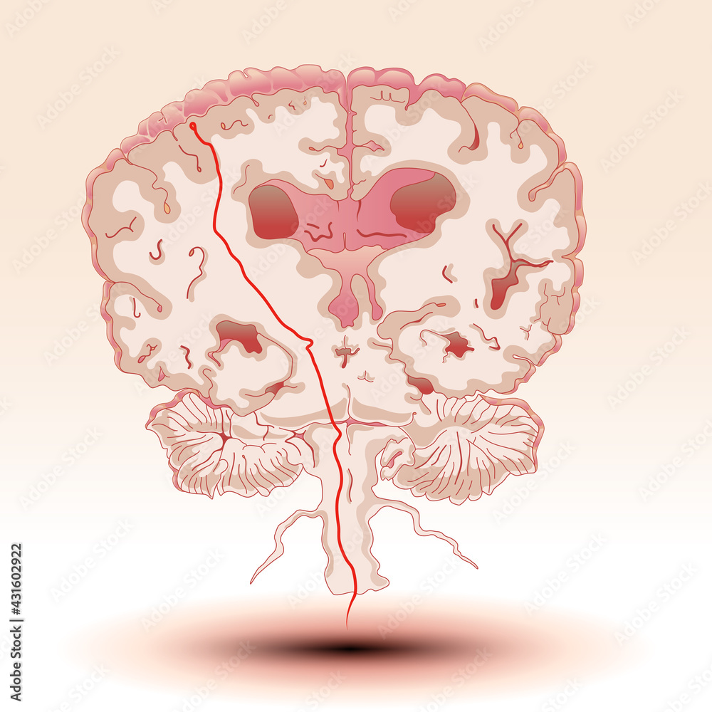 Human brain frontal section vector illustration. Vector frontal view of ...
