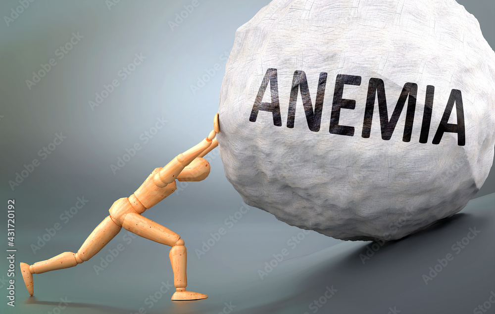 Anemia and painful human condition, pictured as a wooden human figure ...