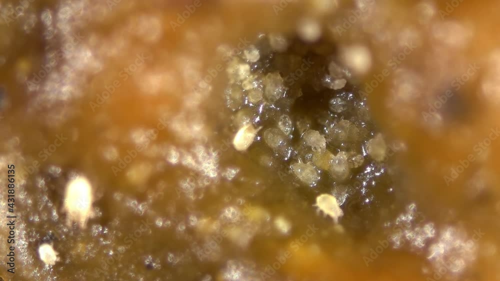 Soil mites of the Acaridae family under a microscope. saprophages feed ...