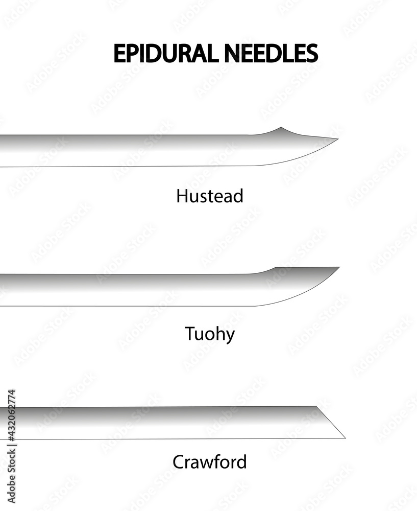 Epidural Needle. Different types of epidural needles side profile view ...