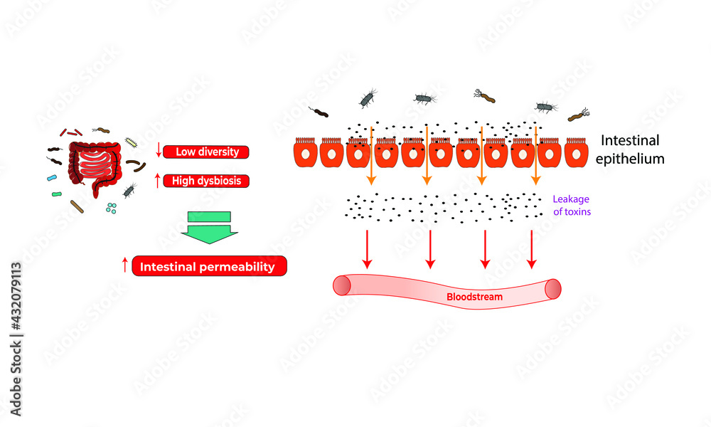 Microbiota and dysbiosis Stock Vector | Adobe Stock
