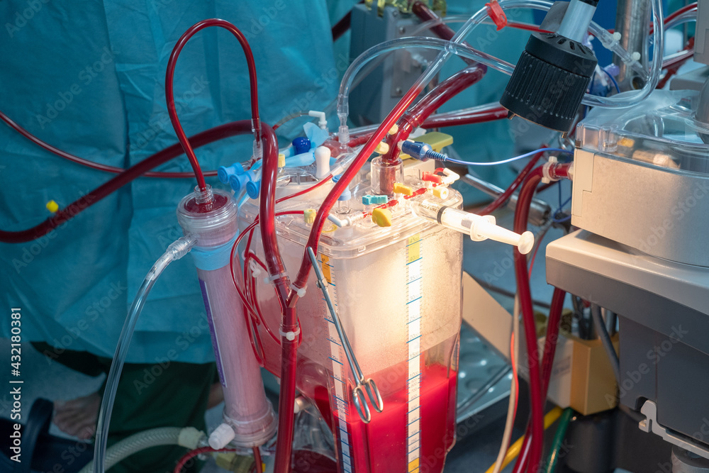 Heart lung machine for heart surgery in operating room. Roller pumps of ...