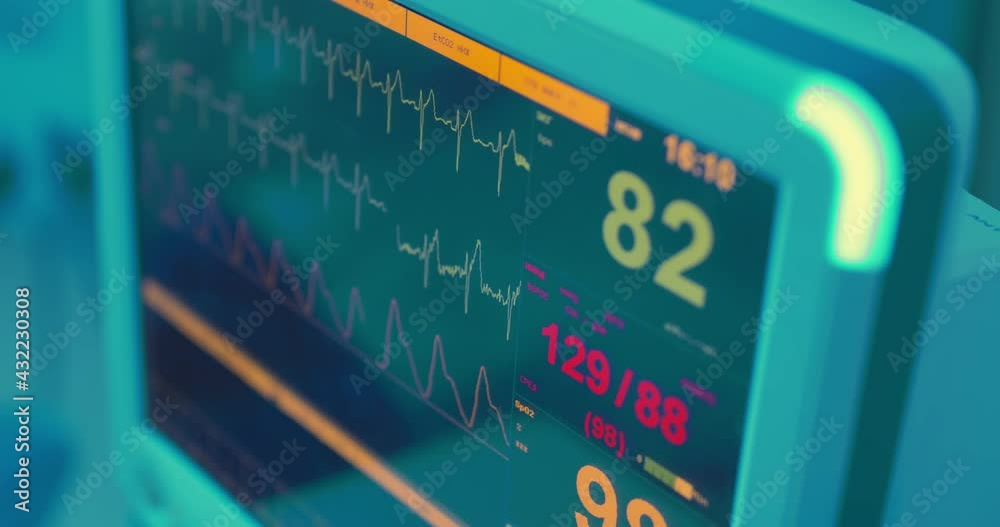 Close-up patient's monitor screen with diagrams: electrocardiogram ...