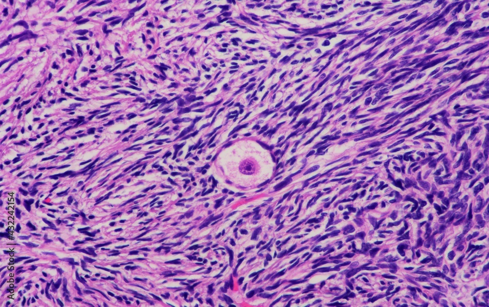 Foto Stock A single egg cell inside a woman's ovary surrounded by ...