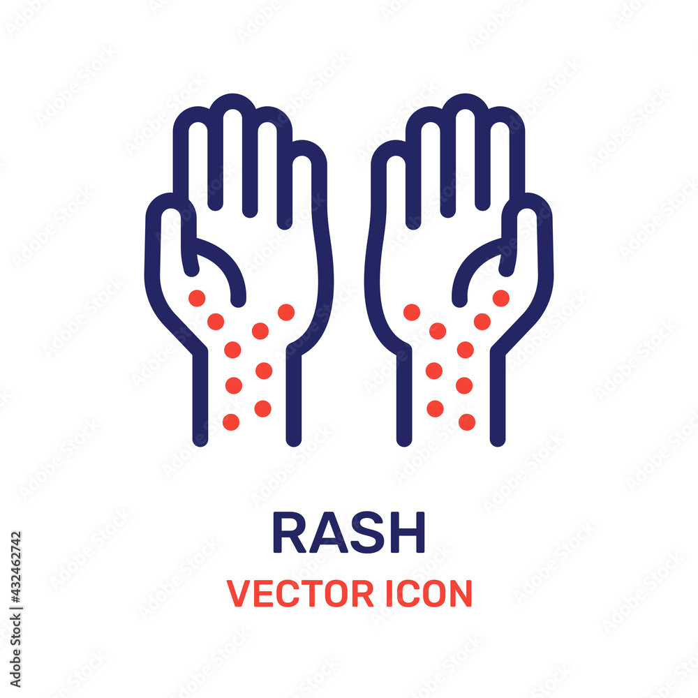 Hand rash icon vector. Allergy icon Stock Vector | Adobe Stock
