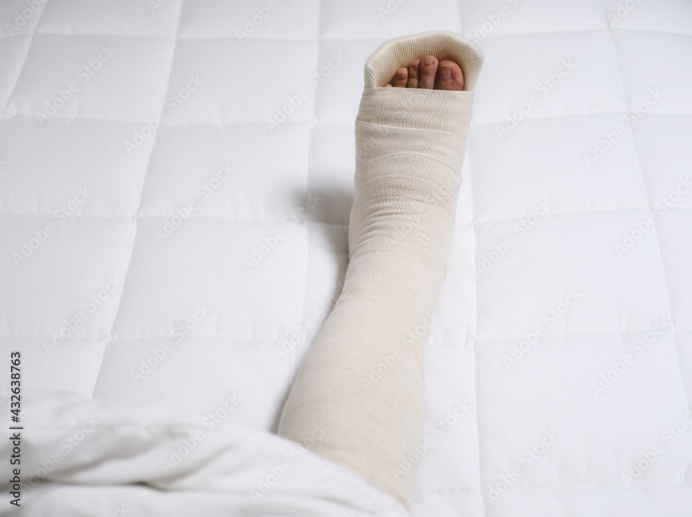 splint a broken leg Stock Photo | Adobe Stock