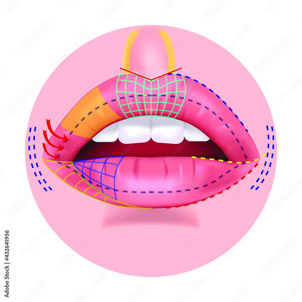 Lip Anatomy Division Into Separate Zones Cosmetology And Plastic Surgery Vector Illustration