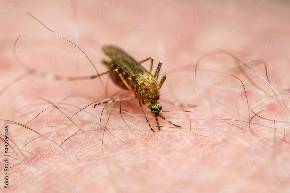 Zika Infected Mosquito Bite. Leishmaniasis, Encephalitis, Yellow Fever ...