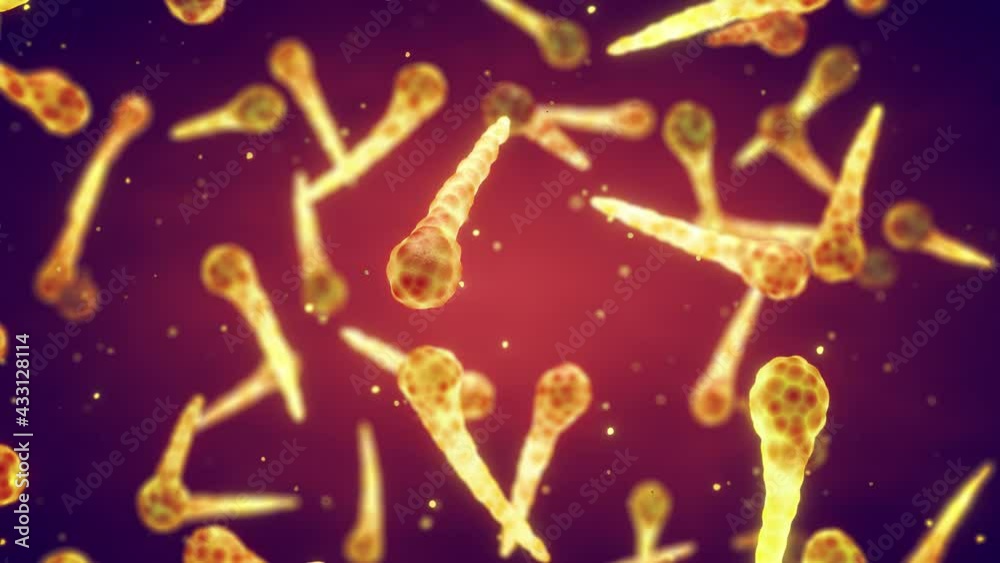 Video Stock Tetanus is an infectious disease caused by the pathogenic ...