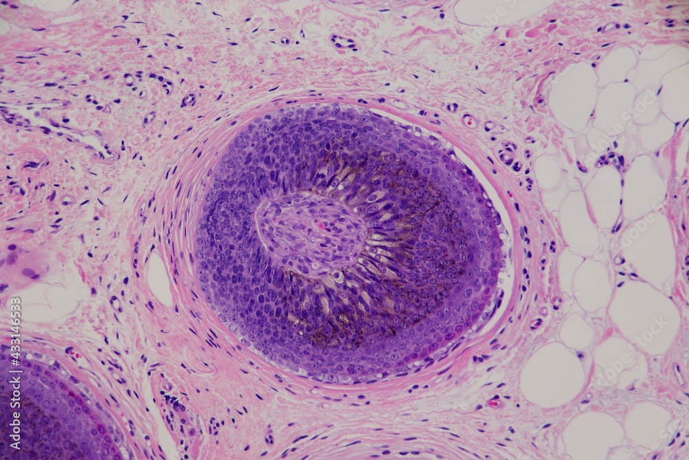 Cross section of a scalp hair root or bulb surrounded by fat cells and ...