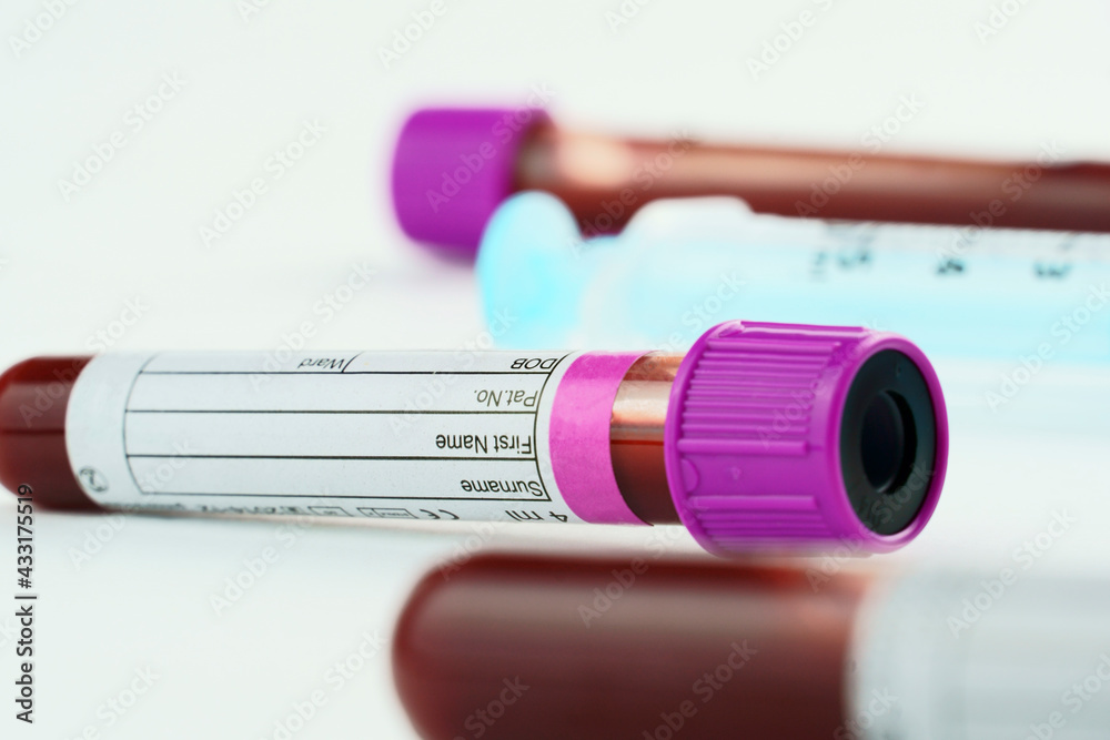 Vacuum tubes for collection and blood samples on white background ...