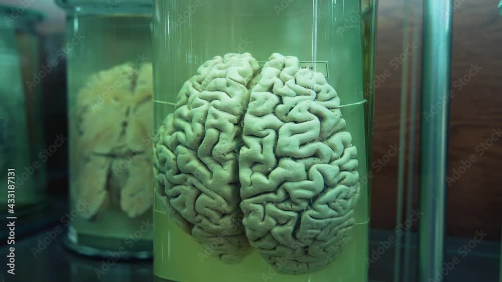 Organs in anatomical museum. Human organs in jars with formalin in ...