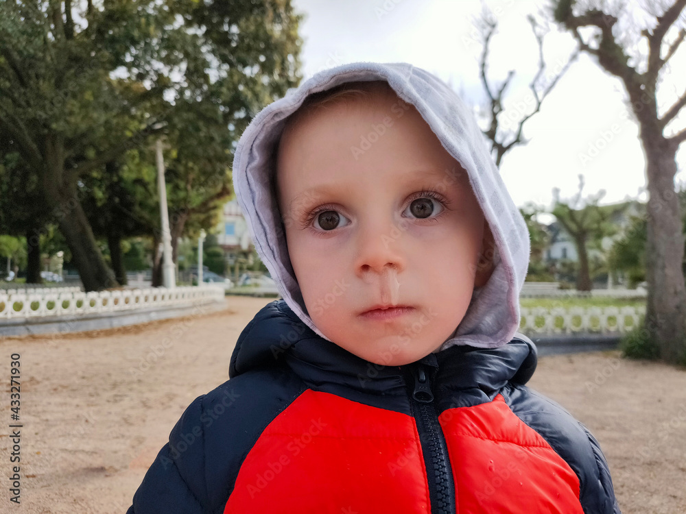 boy with a lot of snot on his nose Stock Photo | Adobe Stock