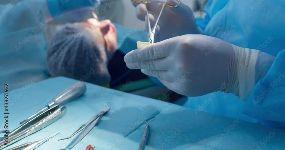 A male dentist's hand is pulling the surgical thread by using dental ...