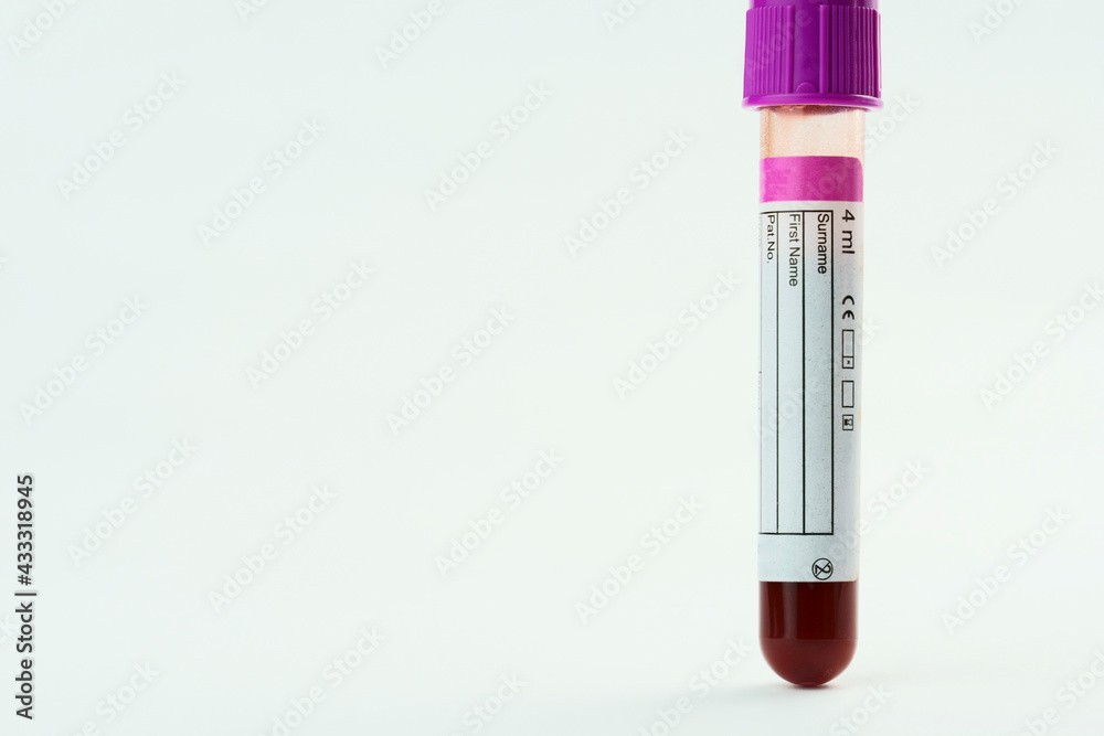 Vacuum tube for collection and blood samples on white background ...