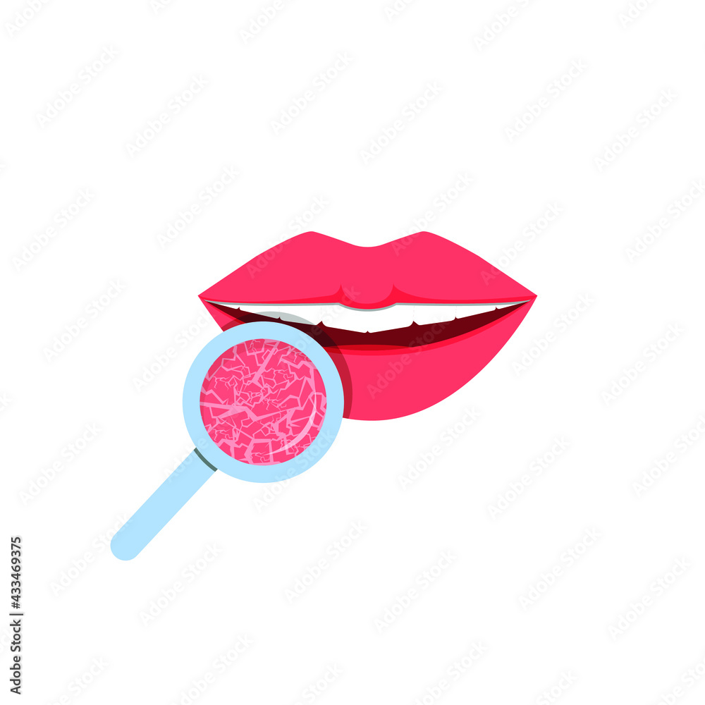 Cartoon Images Of Chapped Lips | Lipstutorial.org