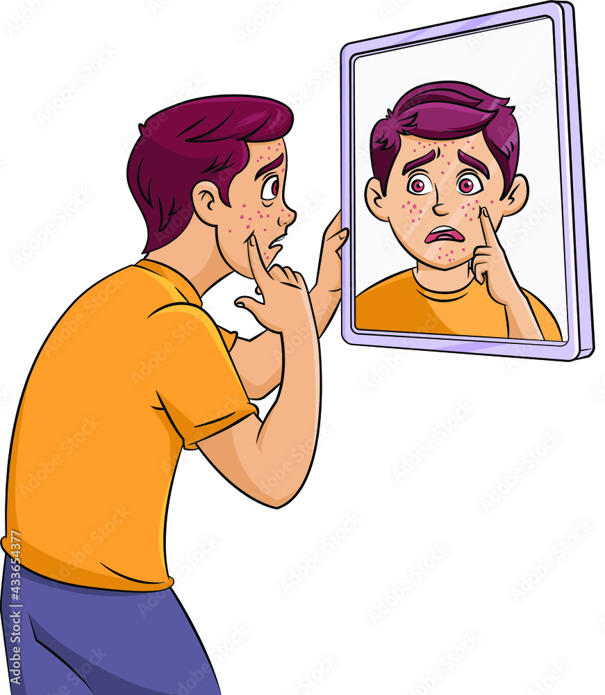 Cartoon vector illustration of a teenage boy with pimples Stock Vector ...
