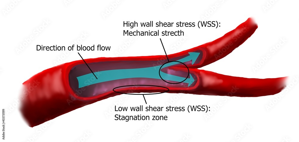 The physiology of blood flow in cerebral artery and wall shear stress ...