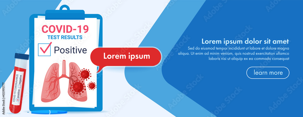 The concept of testing document confirming the coronavirus test with a ...