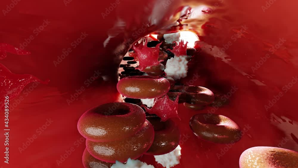 Hemostasis. Red blood cells and platelets in the blood vessel. Basic ...