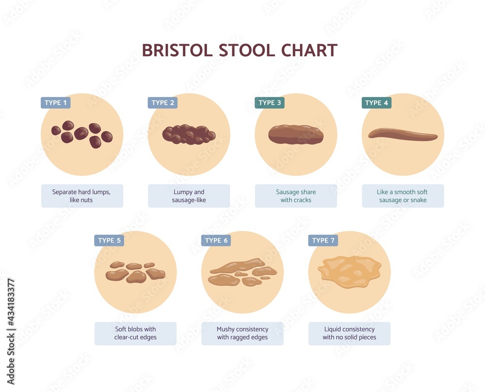 Bristol stool chart with medicine description of human excrements ...