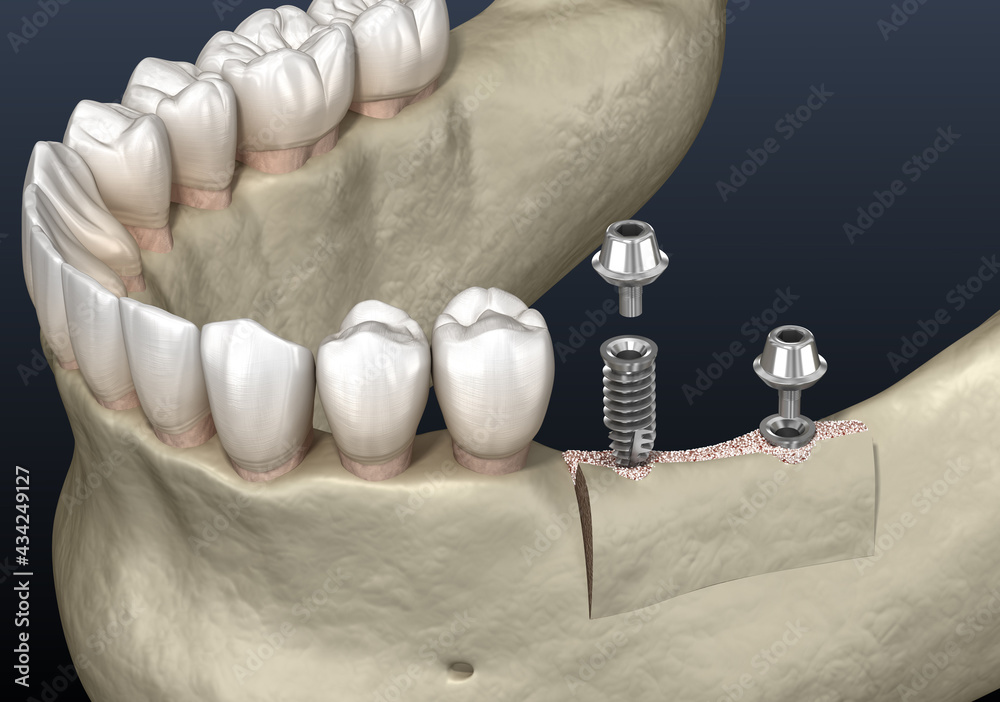 Alveolar Process