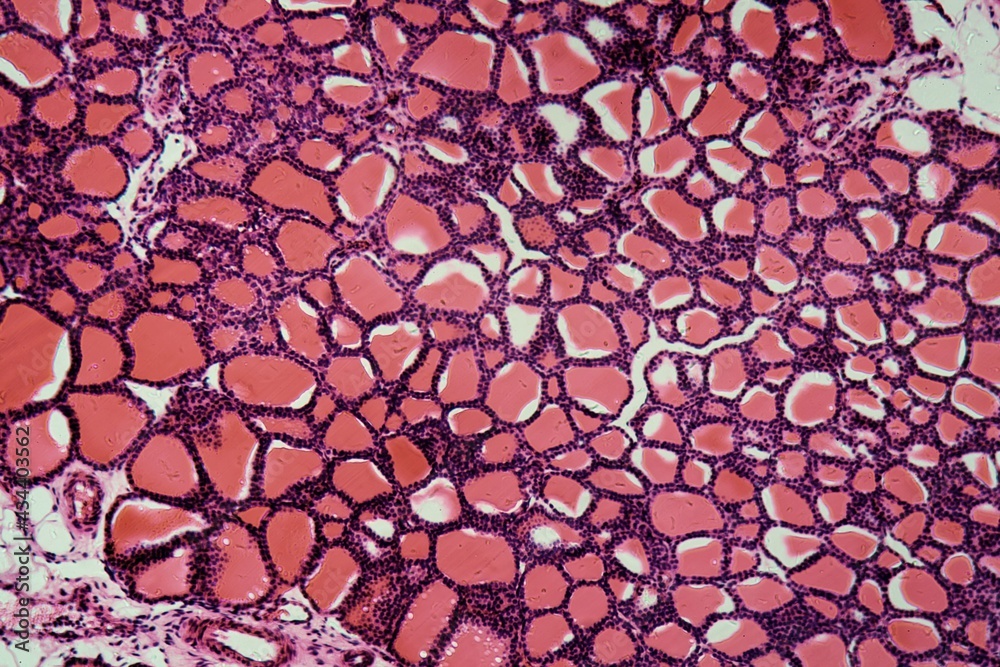 Thyroid gland cells under the microscope Stock Photo | Adobe Stock