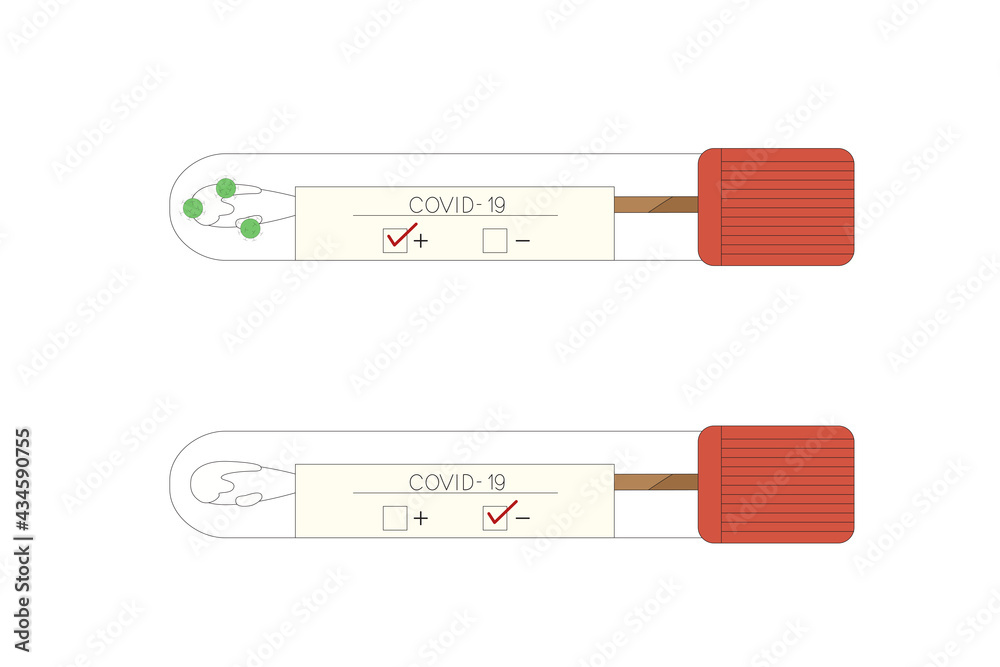 Swab tube for laboratory. COVID-19 test result; positive and negative ...