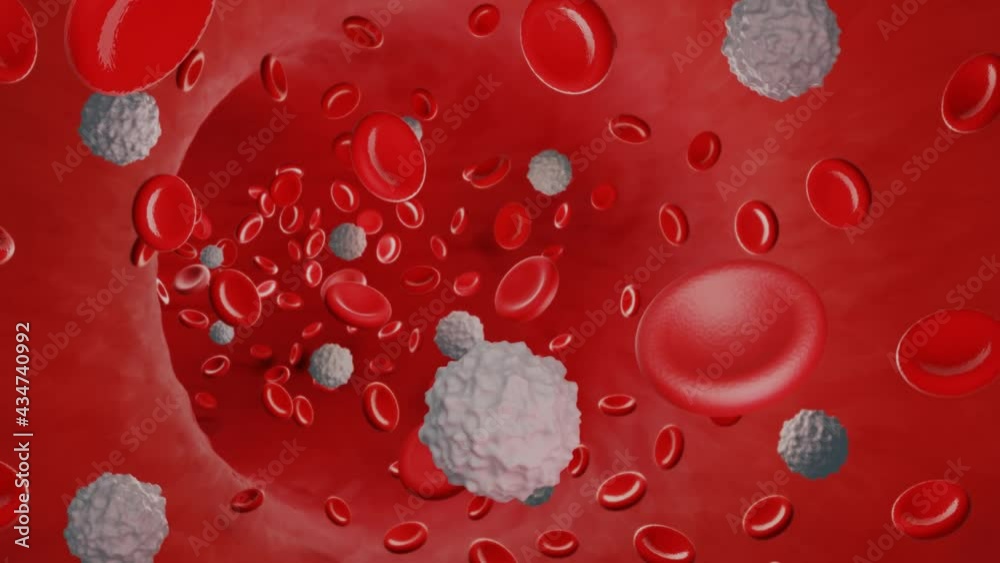 White blood cells in blood flow, Leukemia, Leukocytes and erythrocytes ...