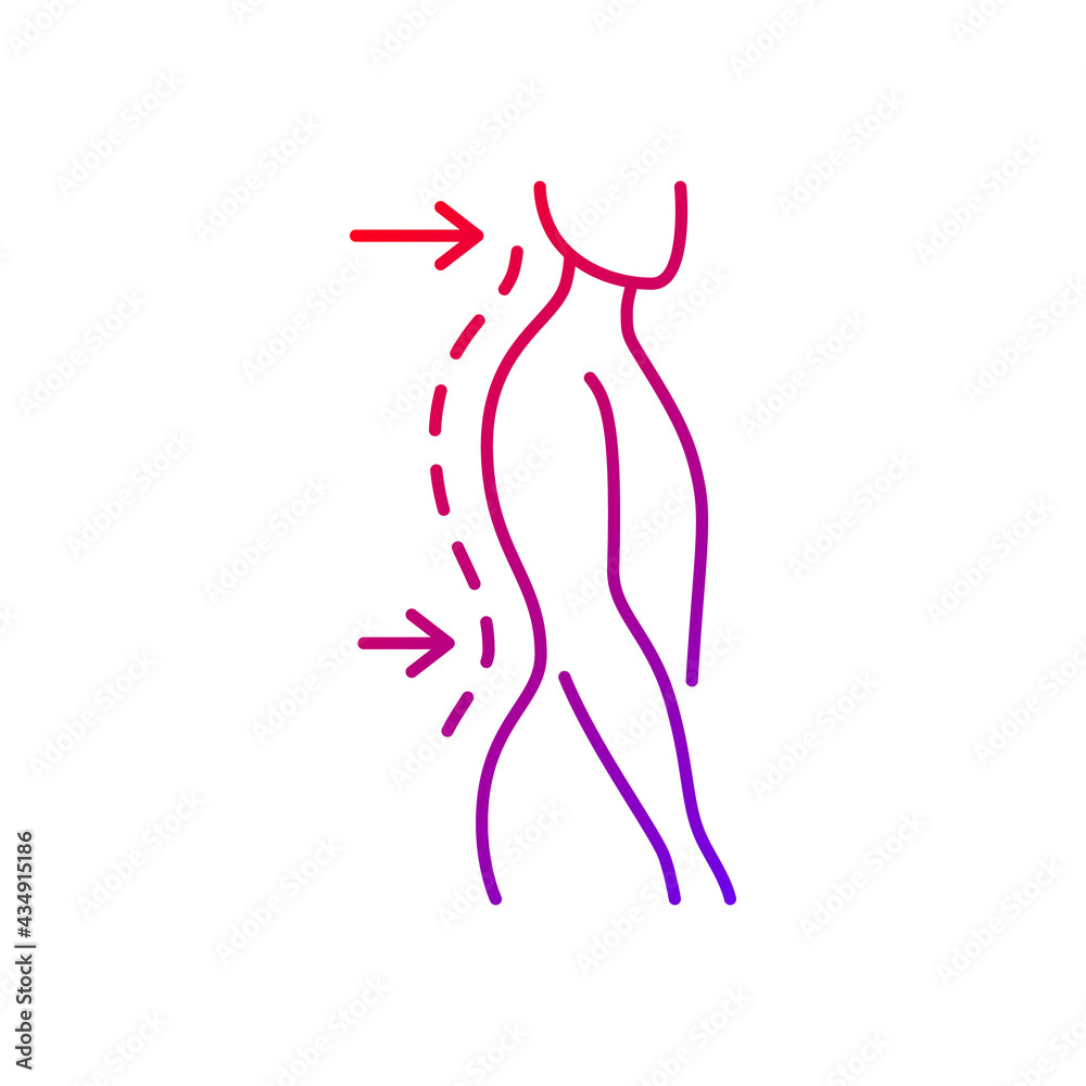 Lumbar lordosis gradient linear vector icon. Excessive inward spine ...