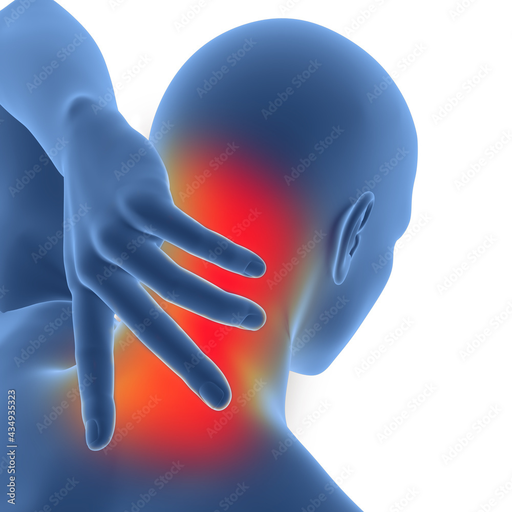 Human Suffering from Neck Pain on Cervial Vertebrae Anatomy Stock ...