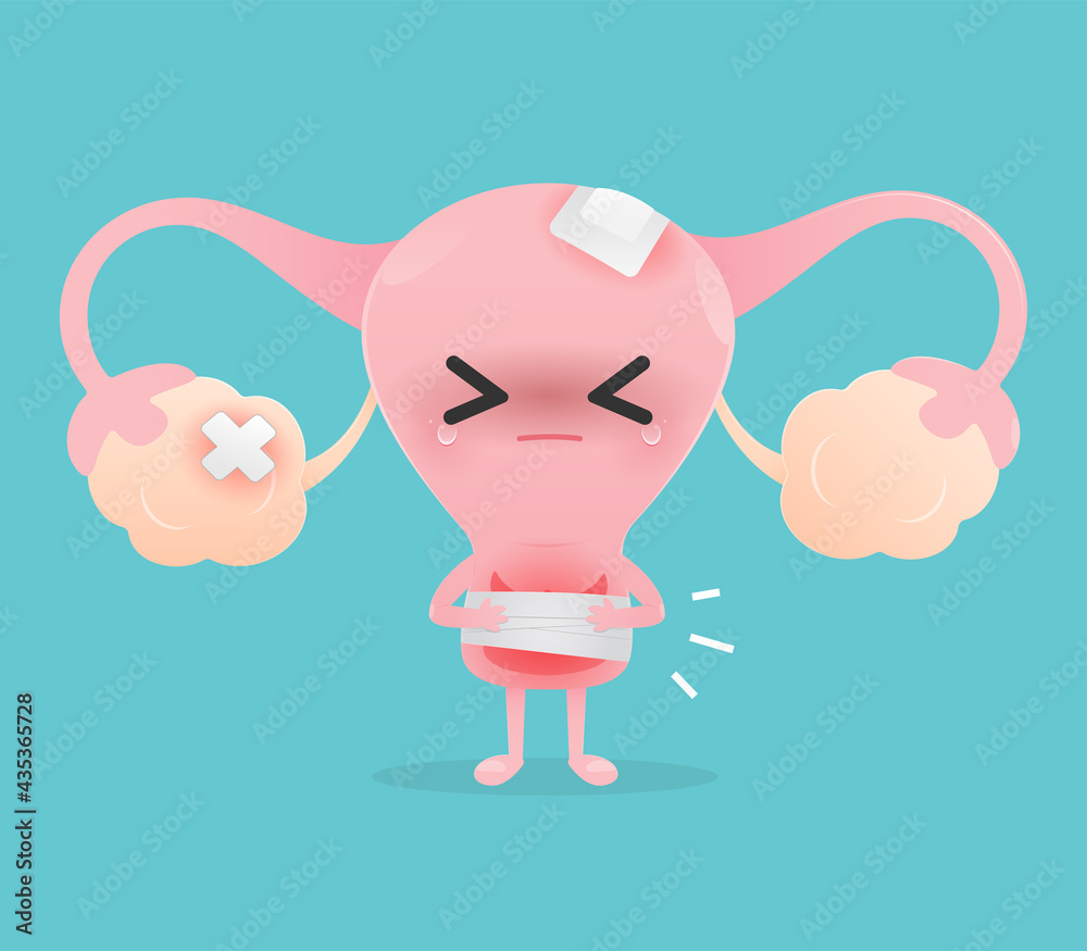 Illustration uterus inflamed ovary against a blue background. Vector ...