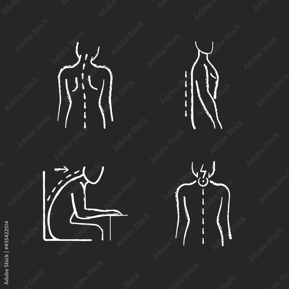 Bad posture problems chalk white icons set on black background. Head ...