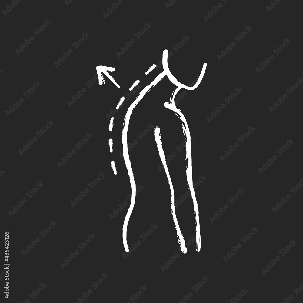Thoracic kyphosis chalk white icon on black background. Prominent ...