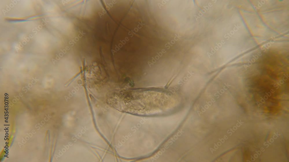 Bacteria Parasites and Worms in drinking Water under Microscope ...